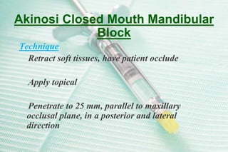 Mandibular injections | PPT
