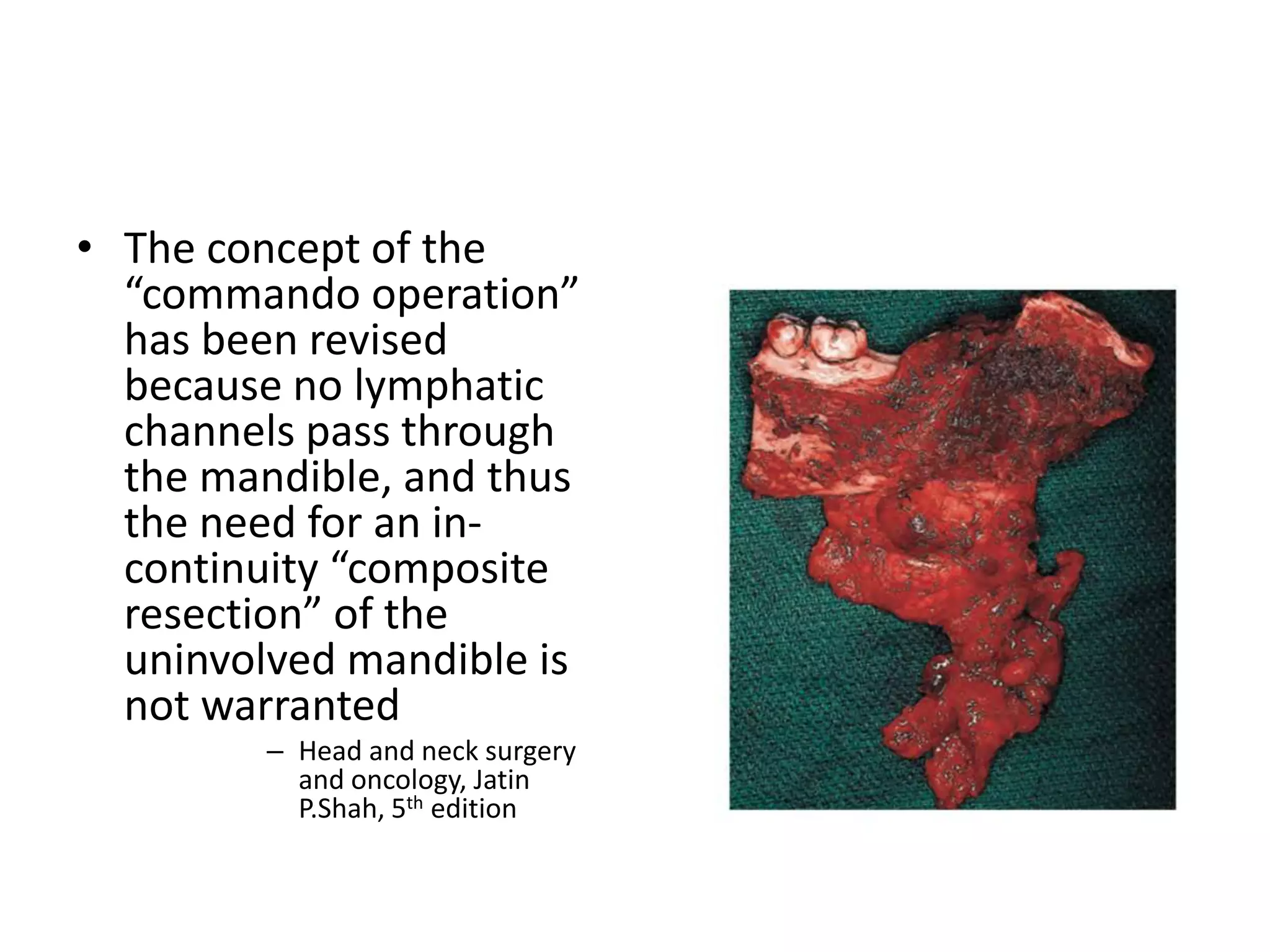 Pattern of Mandibular invasion | PPTX