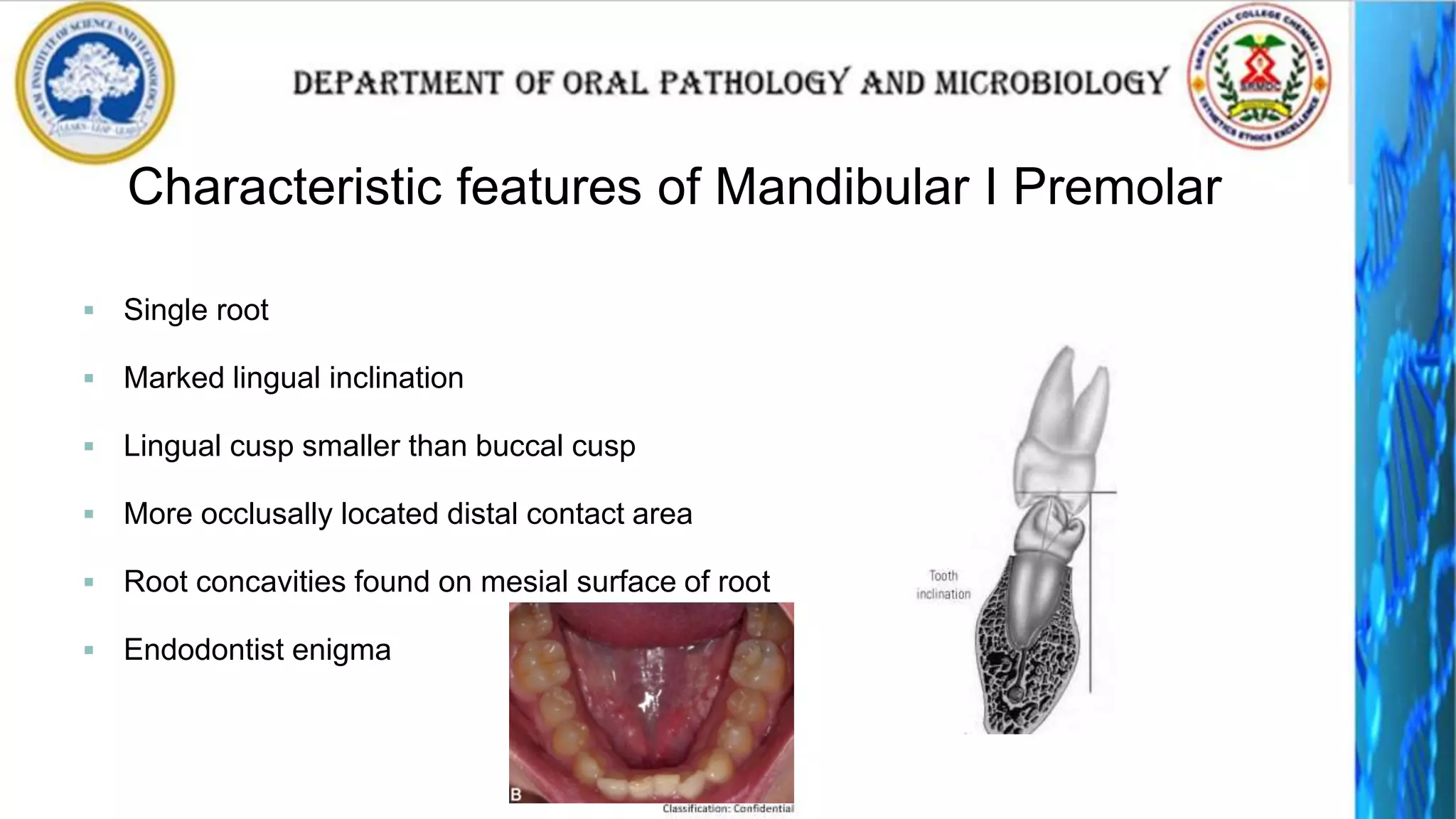 Mandibular I premolar | PPT