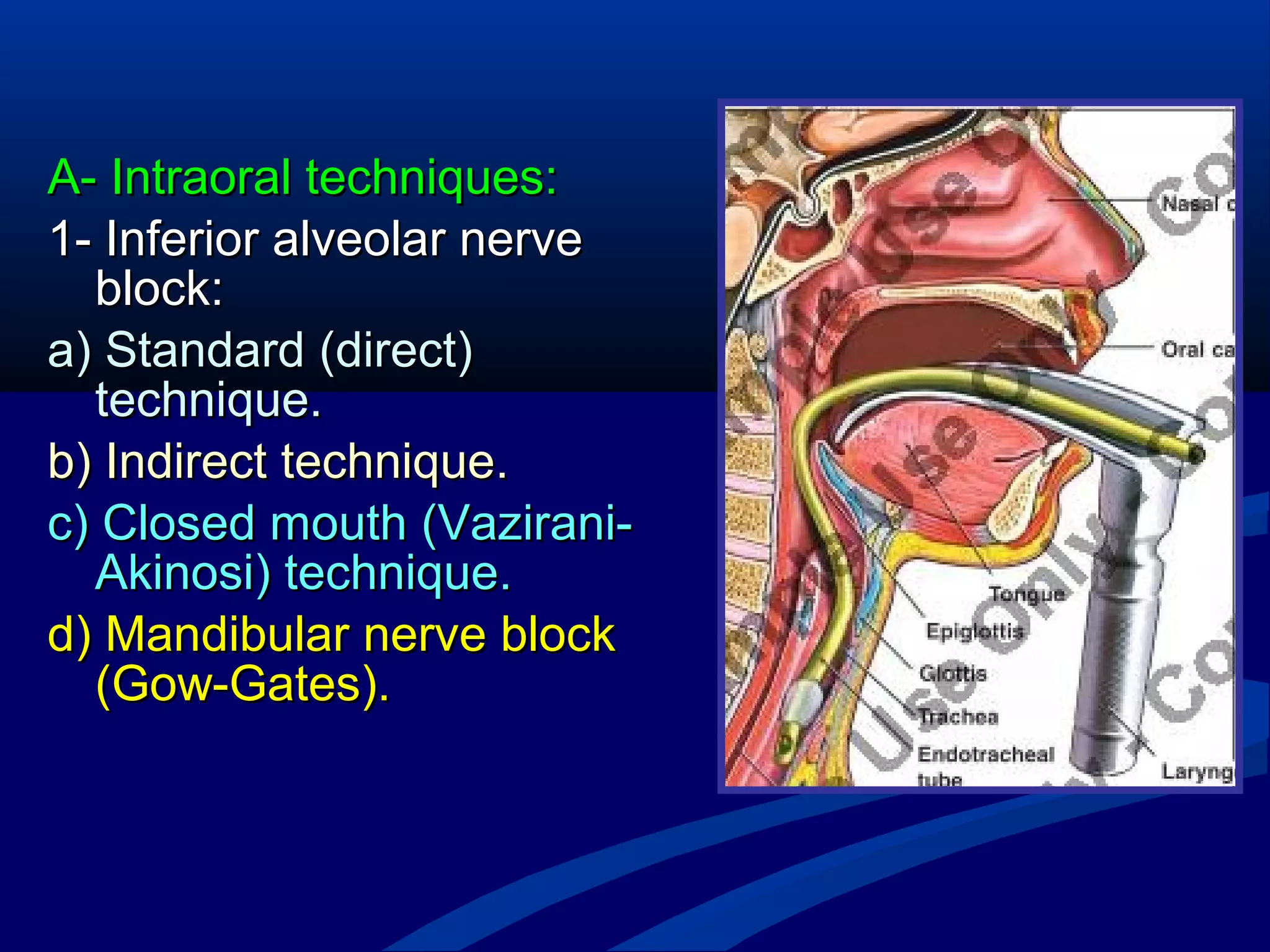 Mandibular Local Anesthesia | PPT