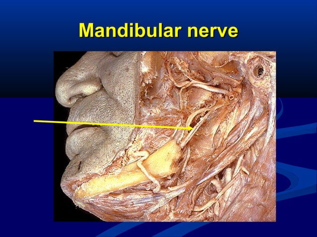 Mandibular Local Anesthesia | PPT