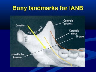 Coronoid Notch