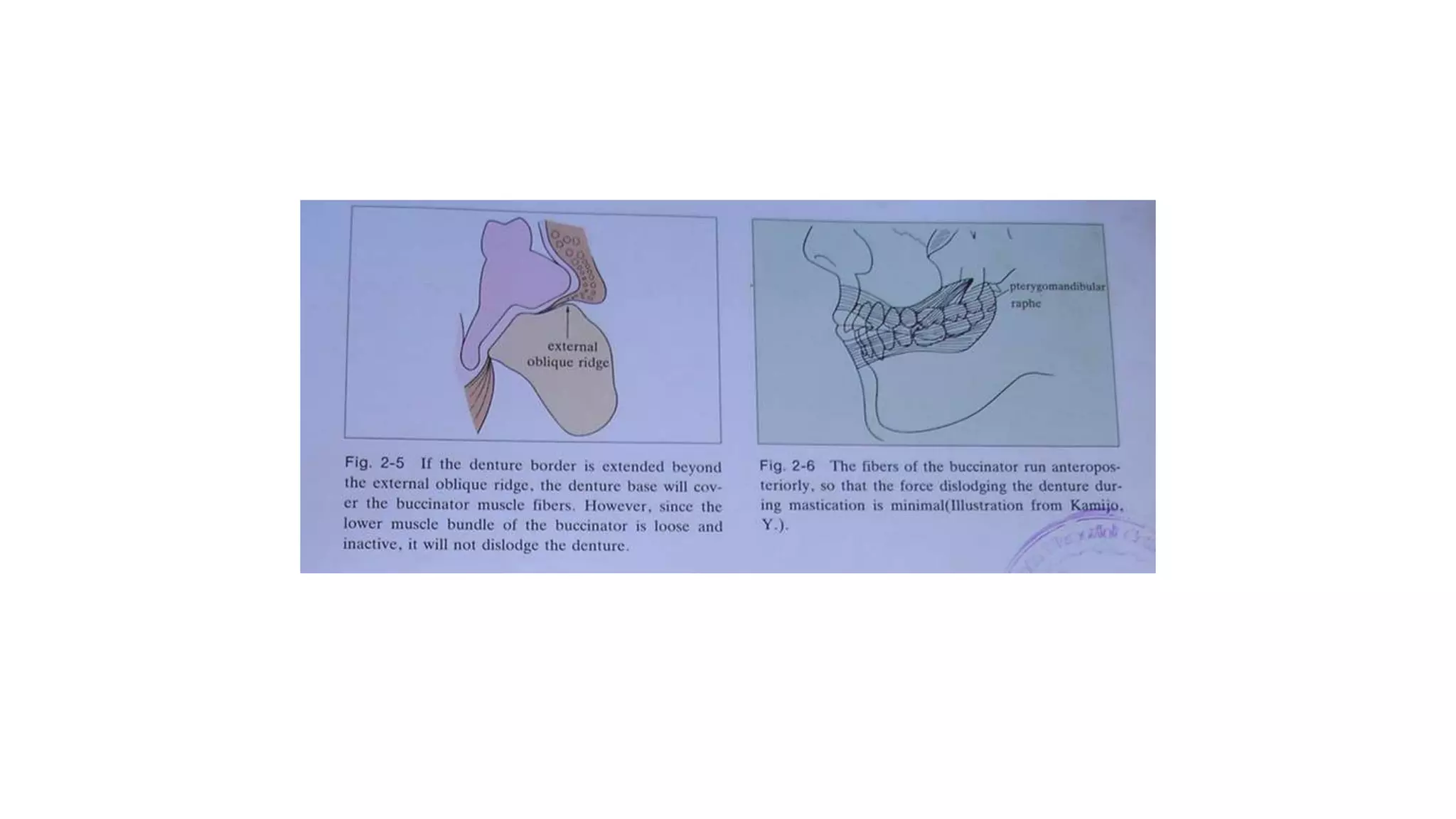 MANDIBULAR ANATOMICAL LANDMARKS | PPTX