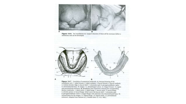 MANDIBULAR ANATOMICAL LANDMARKS | PPTX