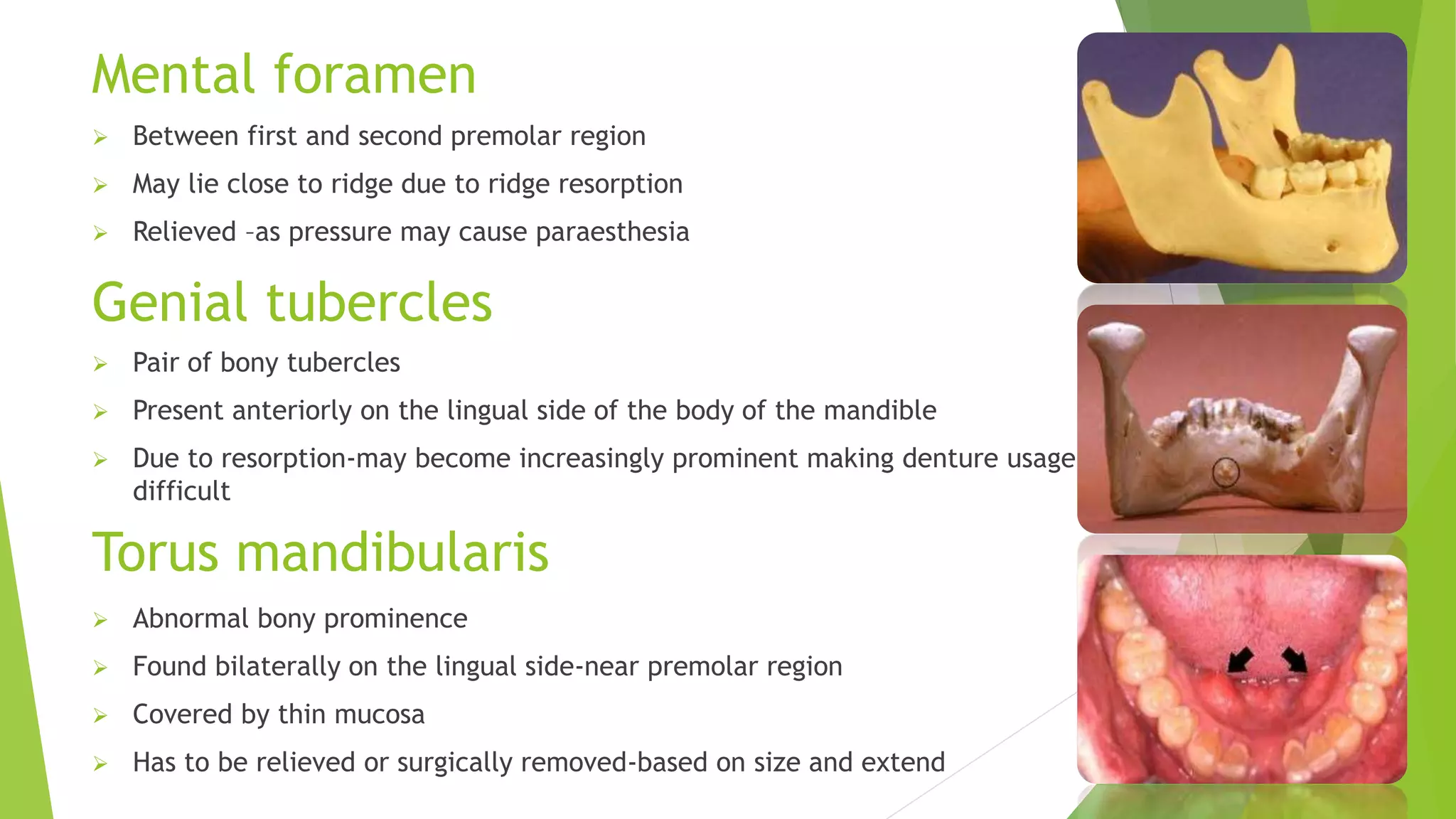 Mandibular landmarks | PPTX