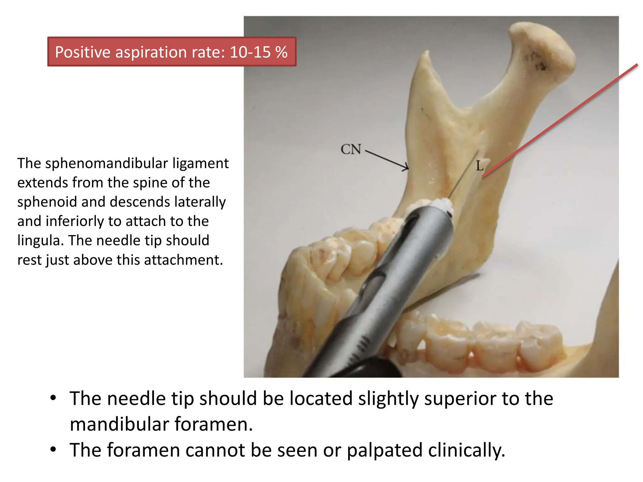 mandibular techniques in your area are here | PDF