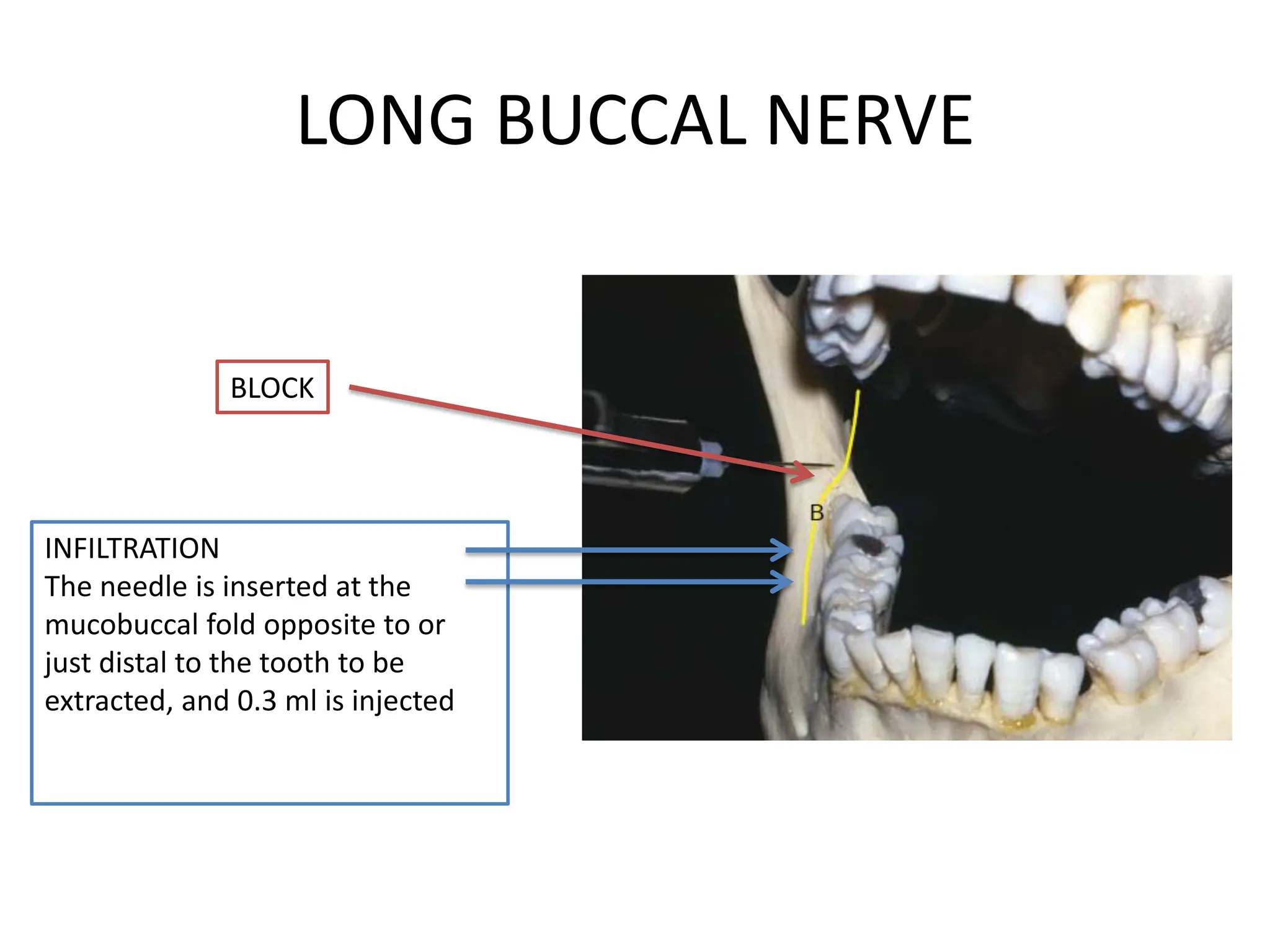 mandibular techniques in your area are here | PDF