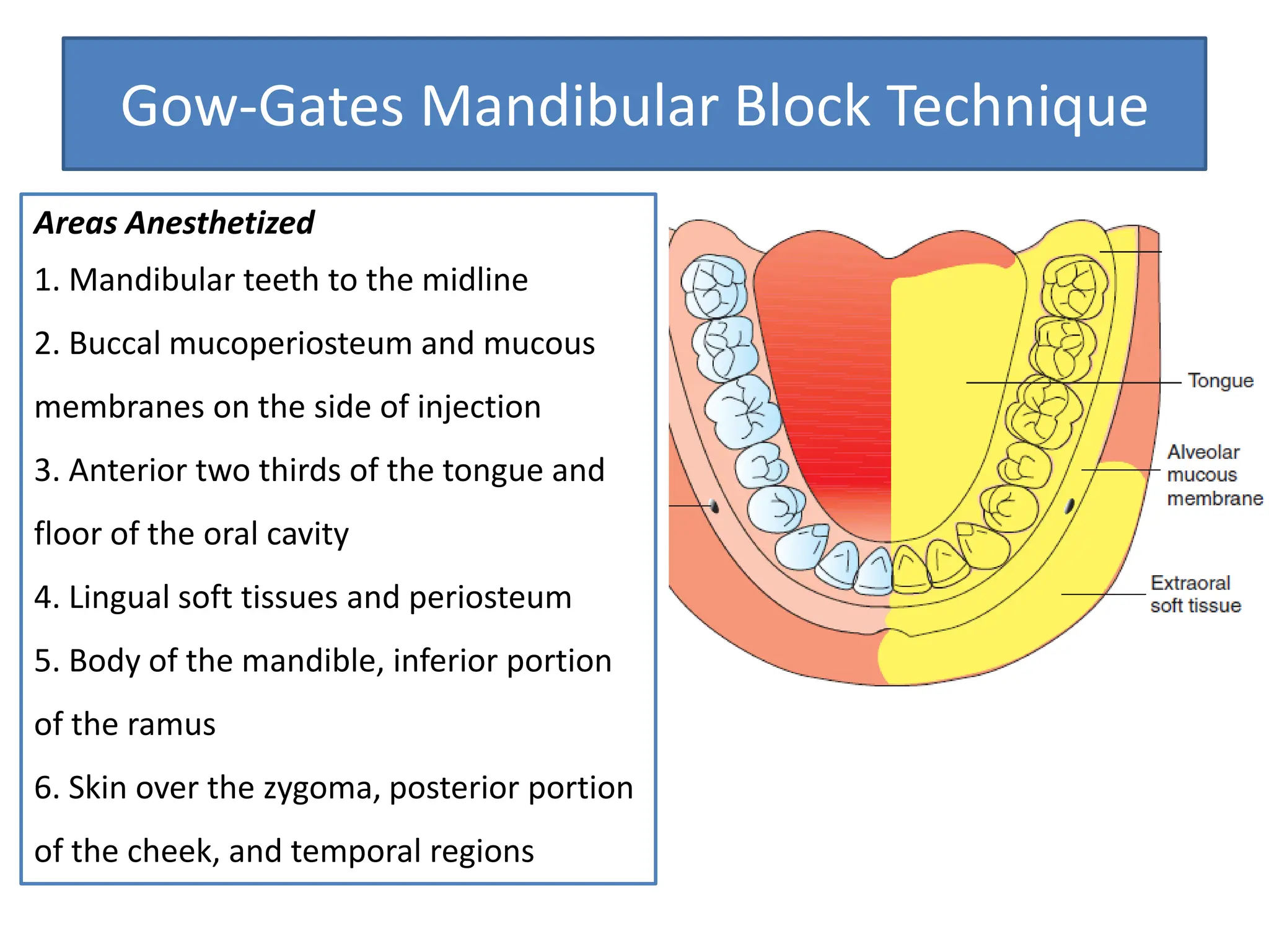 mandibular techniques in your area are here | PDF