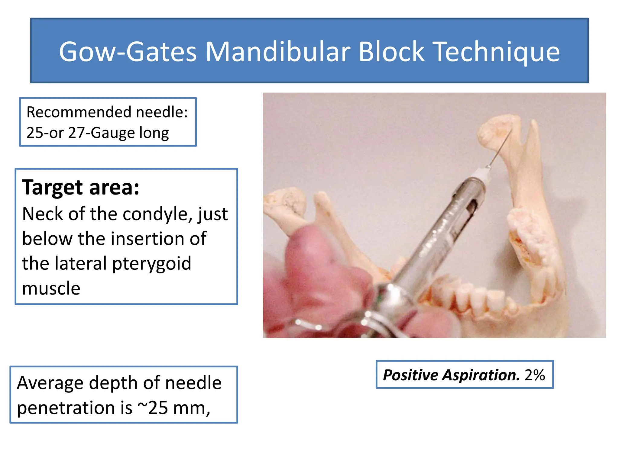 mandibular techniques in your area are here | PDF