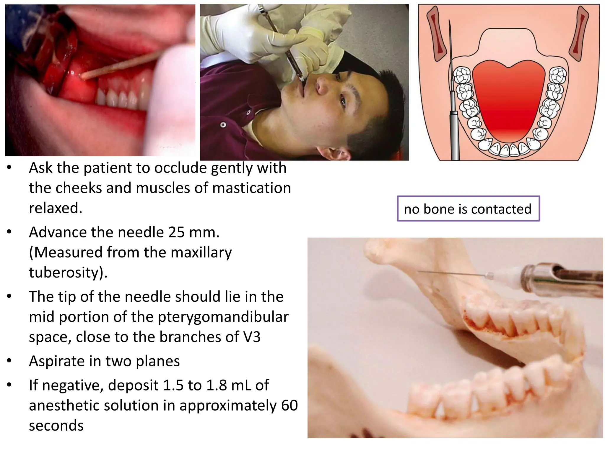 mandibular techniques in your area are here | PDF