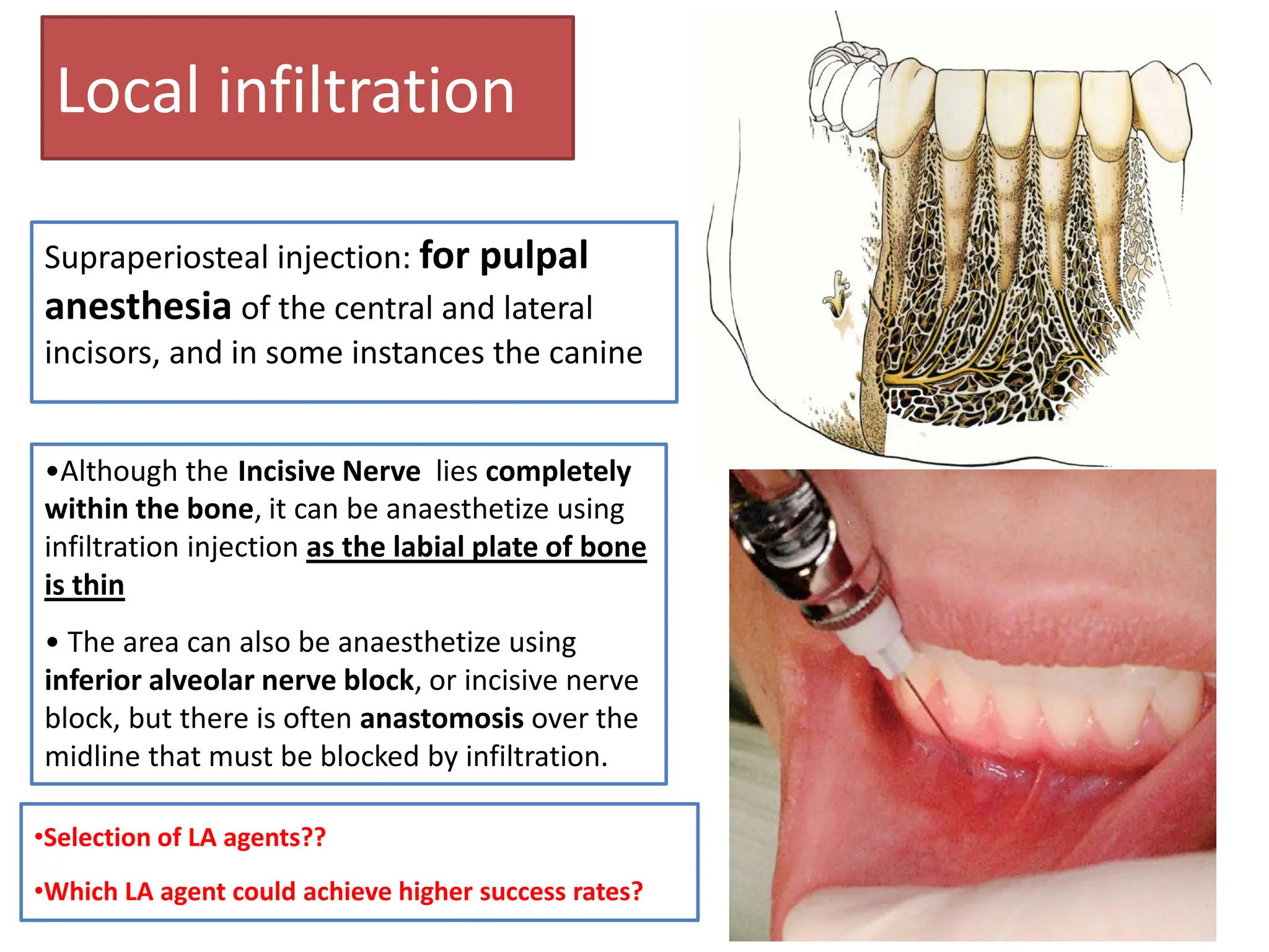 mandibular techniques in your area are here | PDF