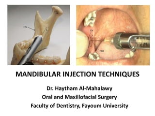 mandibular techniques in your area are here | PPT