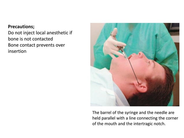 mandibular techniques in your area are here | PDF