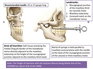 mandibular techniques in your area are here | PDF