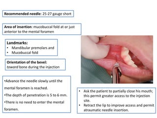 mandibular techniques in your area are here | PDF