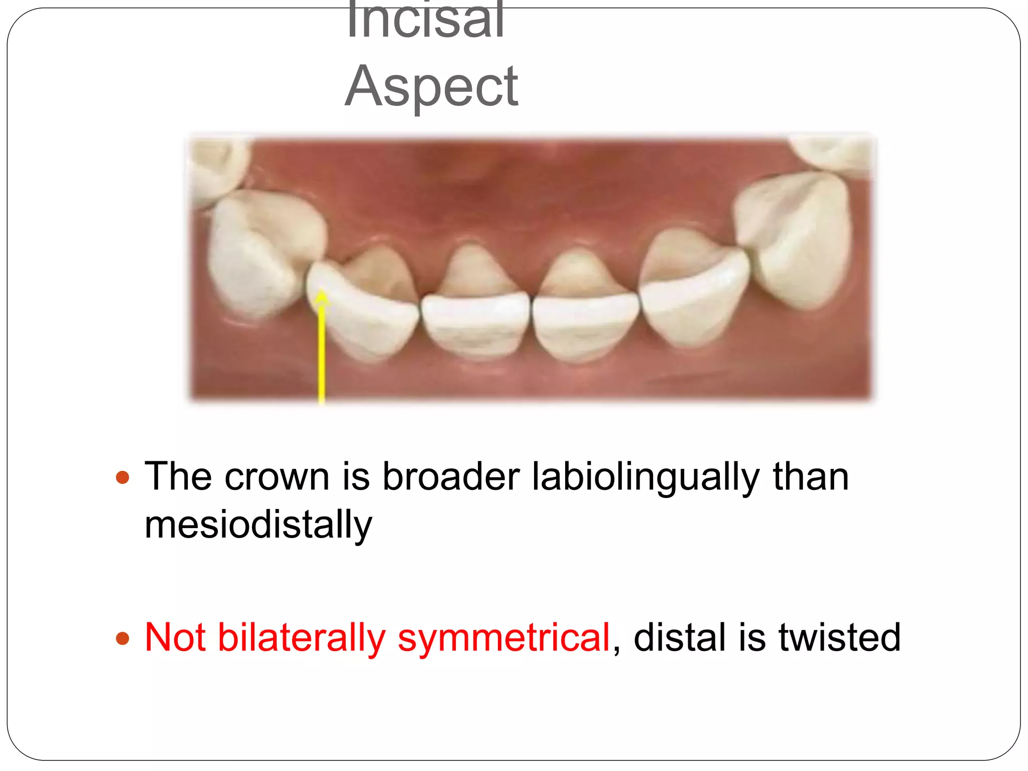 PERMANENT MANDIBULAR LATERAL INCISOR | PPTX