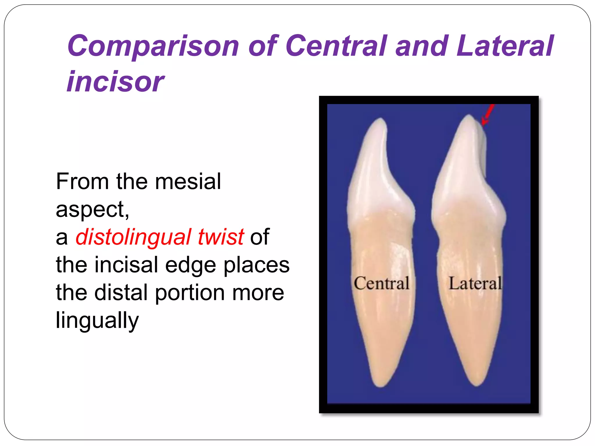 PERMANENT MANDIBULAR LATERAL INCISOR | PPTX