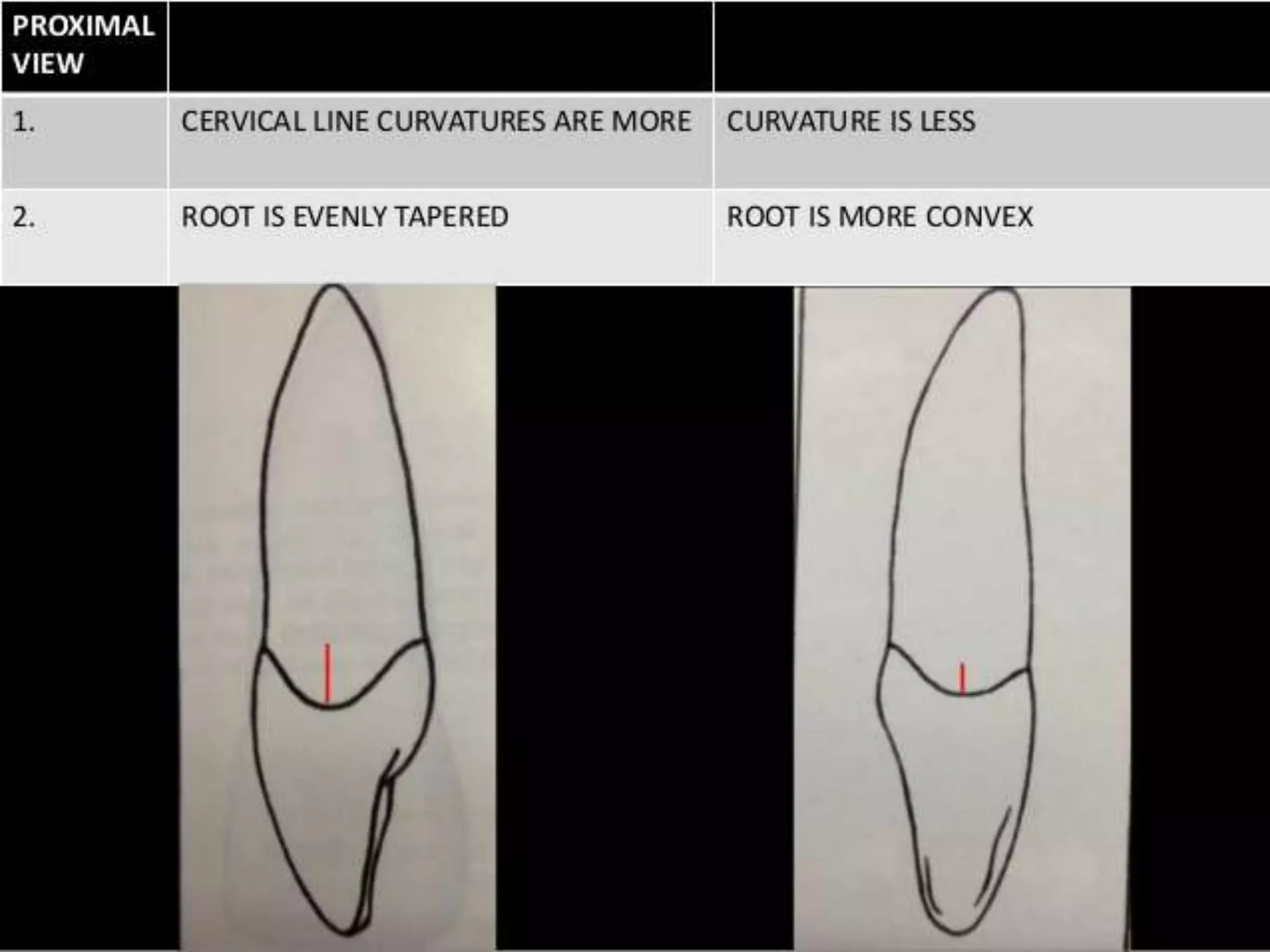 Permanent Mandibular Lateral Incisor | PPTX
