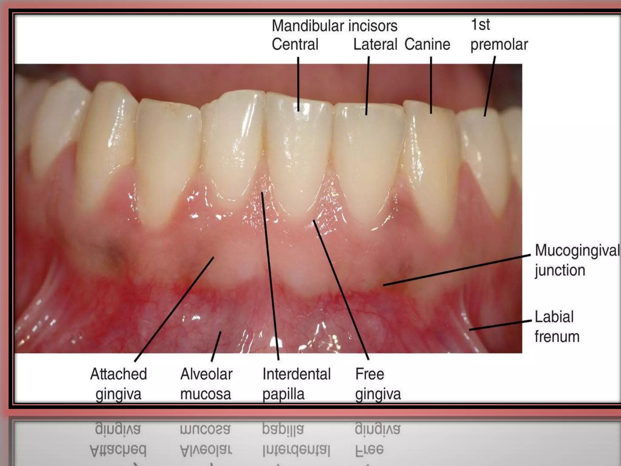 PERMANENT Mandibular lateral incisor | PPT