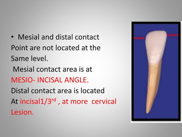 PERMANENT Mandibular lateral incisor | PPT