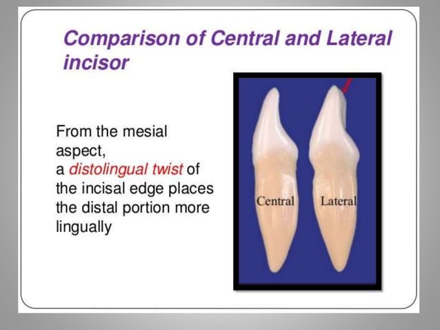 PERMANENT Mandibular lateral incisor | PPT