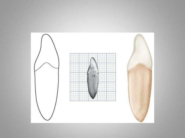 PERMANENT Mandibular lateral incisor | PPT