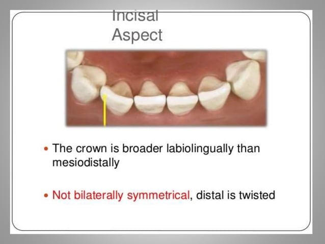 PERMANENT Mandibular lateral incisor | PPT