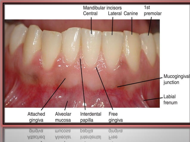 PERMANENT Mandibular lateral incisor | PPT