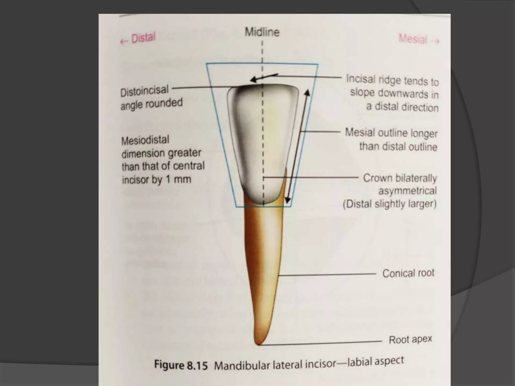 MANDIBULAR LATERAL INCISOR.pptx