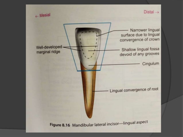 MANDIBULAR LATERAL INCISOR.pptx