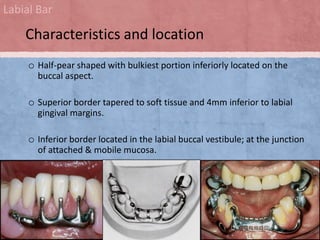 Mandibular Major Connectors | PPTX | Dental Health | Diseases and ...