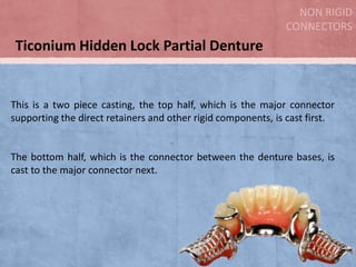 Mandibular Major Connectors | PPTX