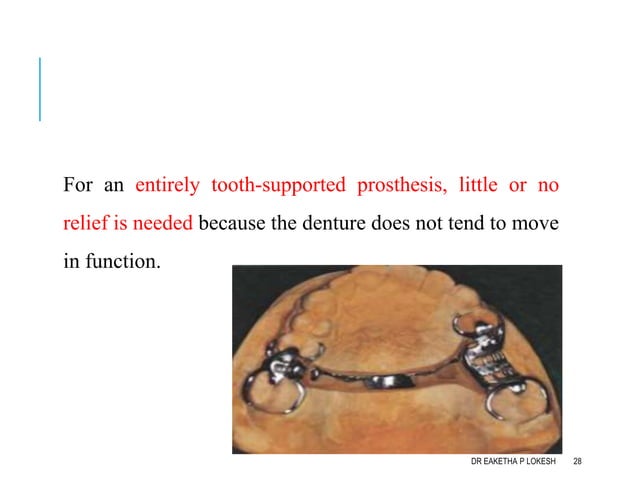 Mandibular major connectors | PPTX | Dental Health | Diseases and ...