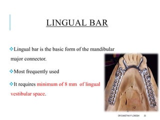Mandibular major connectors | PPTX