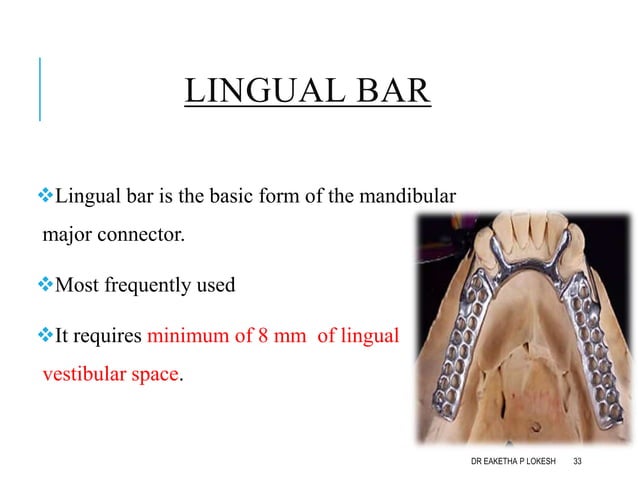 Mandibular major connectors | PPTX | Dental Health | Diseases and ...