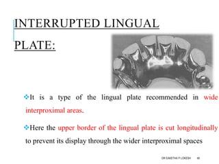Mandibular major connectors | PPTX
