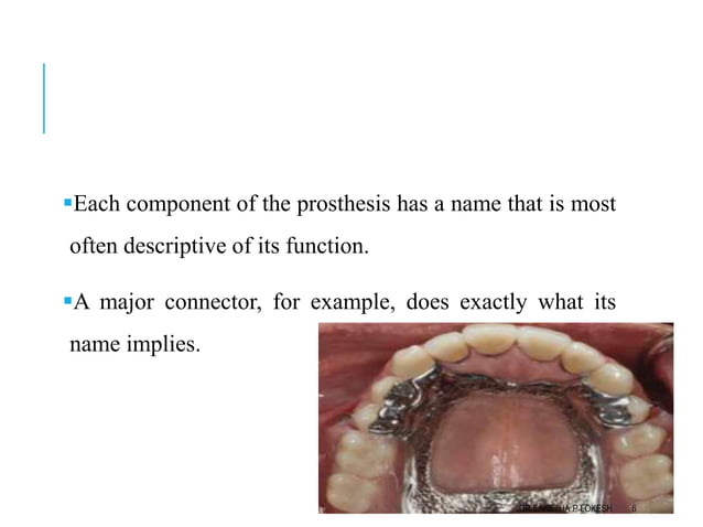 Mandibular major connectors | PPTX | Dental Health | Diseases and ...
