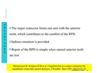 Mandibular major connectors | PPTX