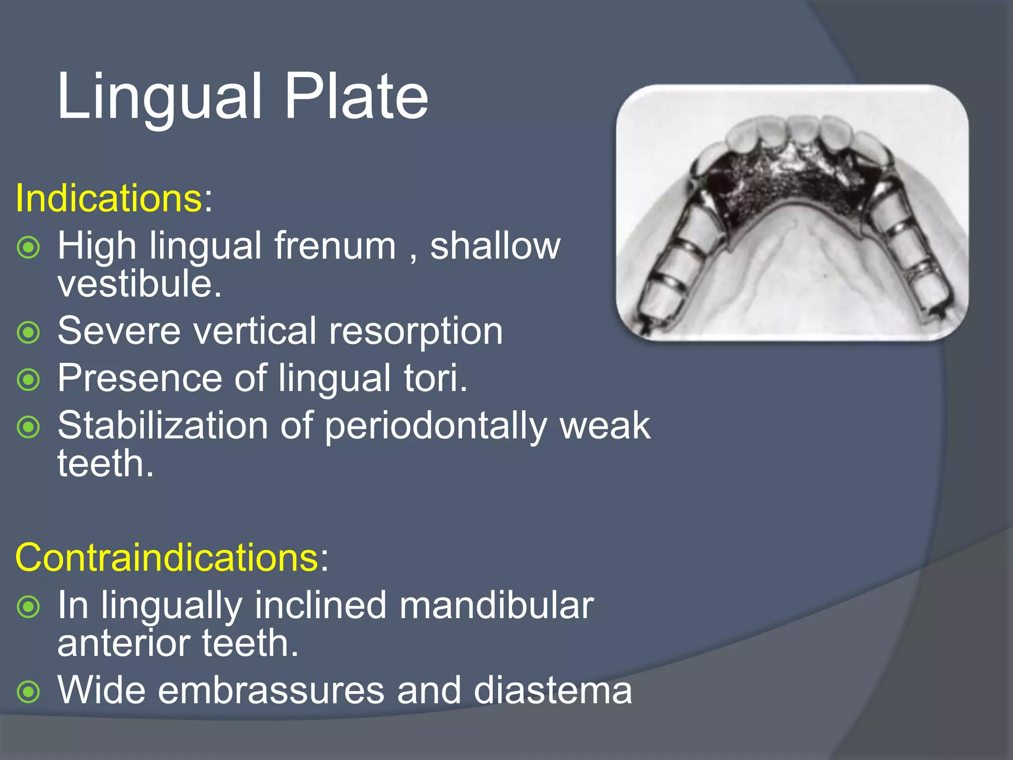 Mandibular Major Connectors | PPTX