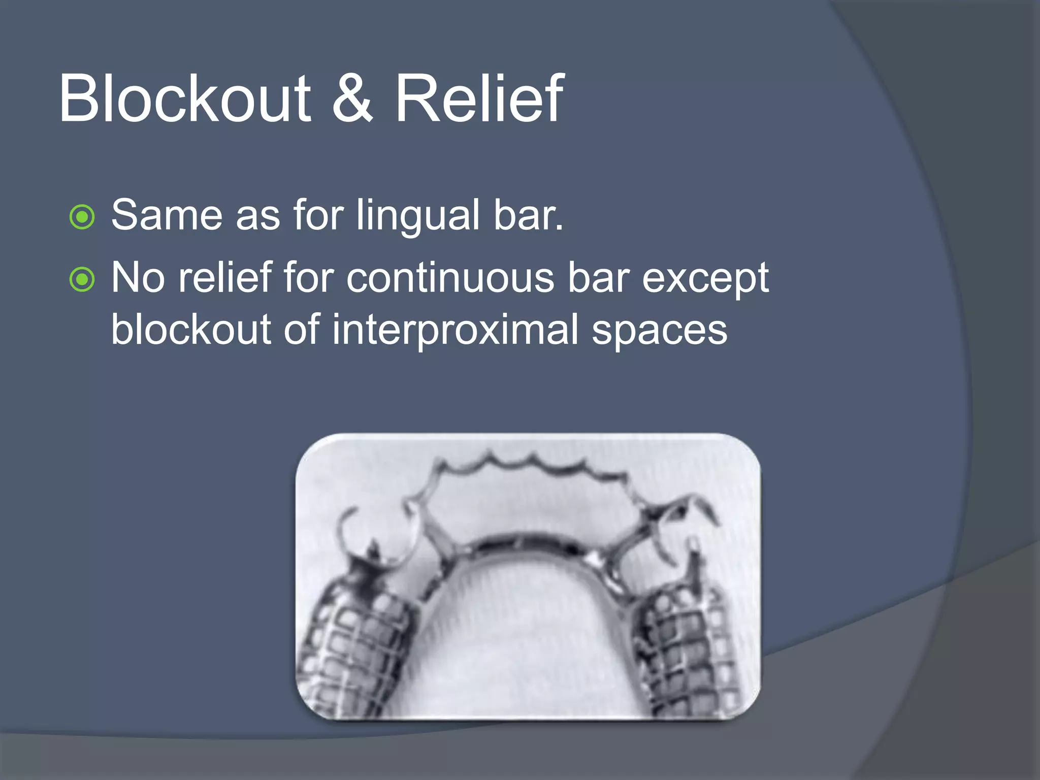 Mandibular Major Connectors | PPTX