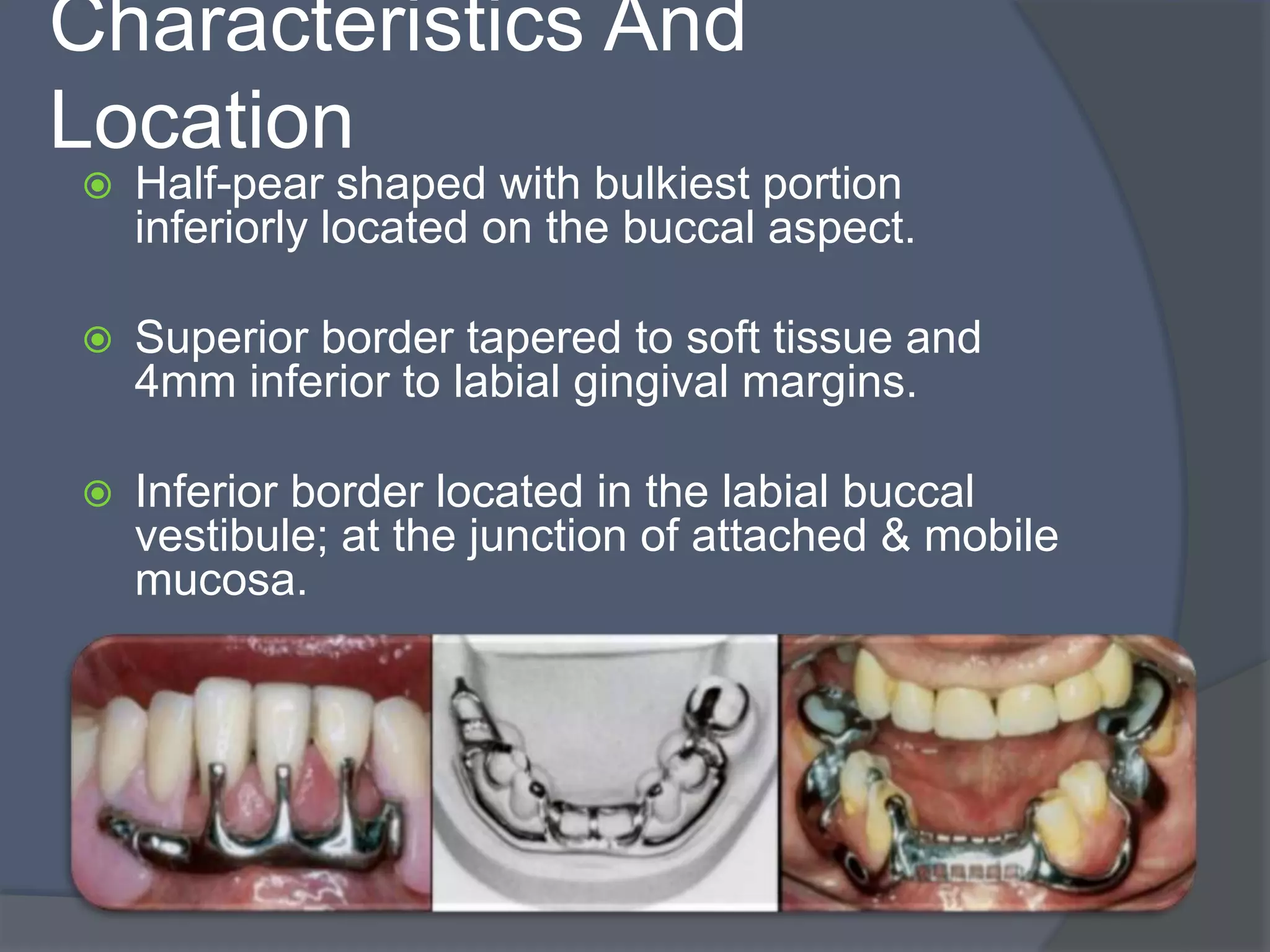 Mandibular Major Connectors | PPTX