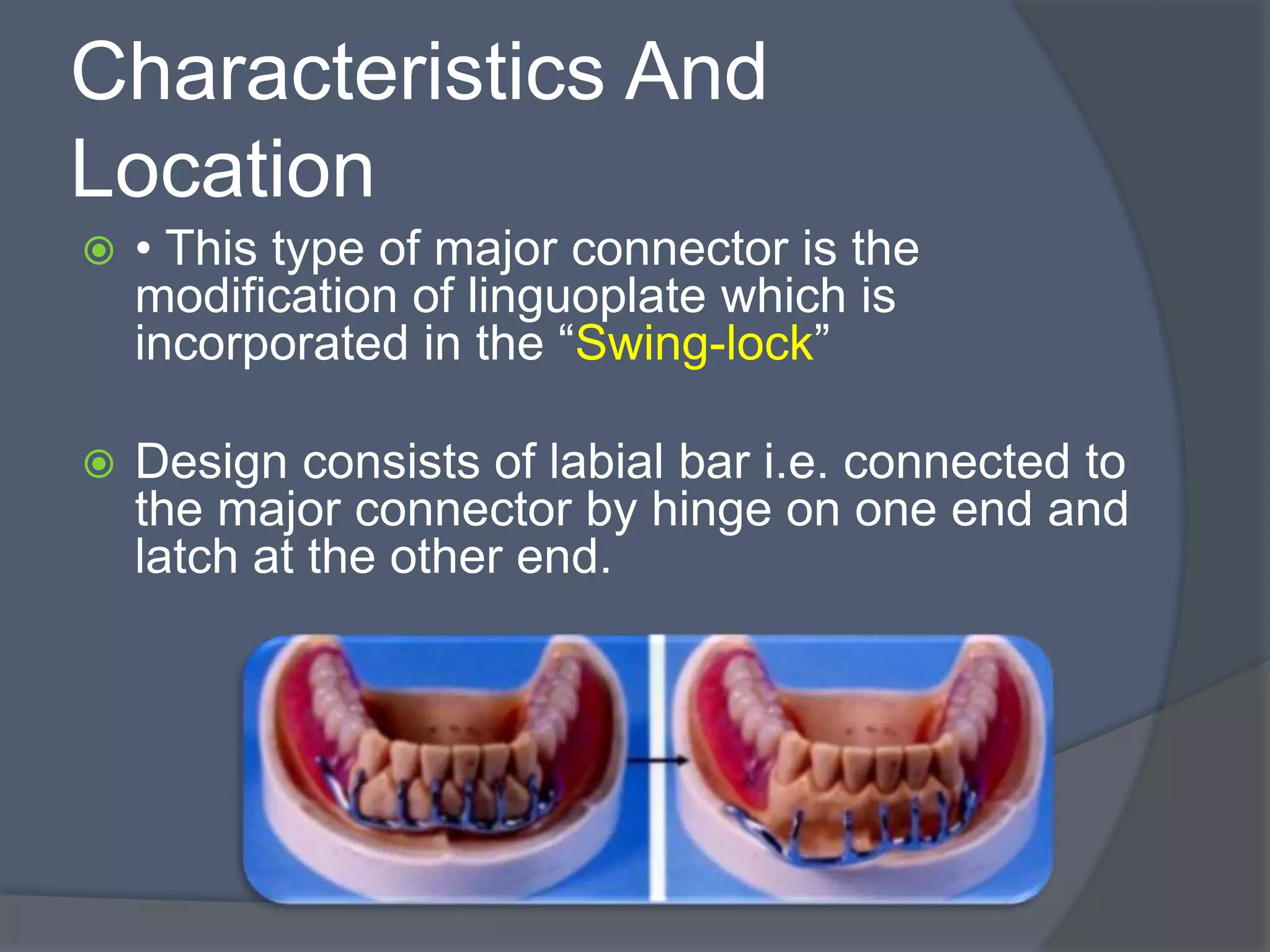 Mandibular Major Connectors | PPTX