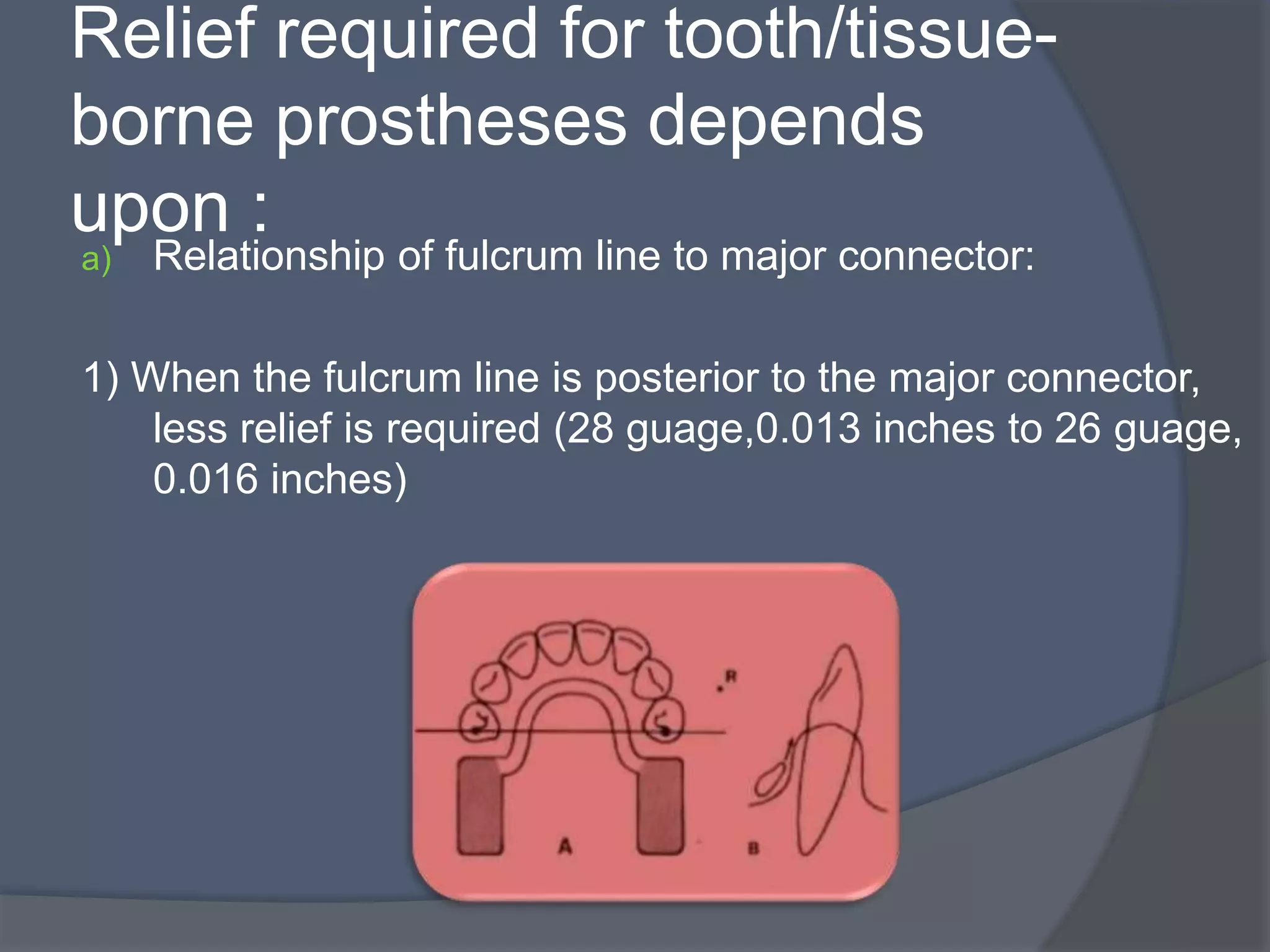 Mandibular Major Connectors | PPTX