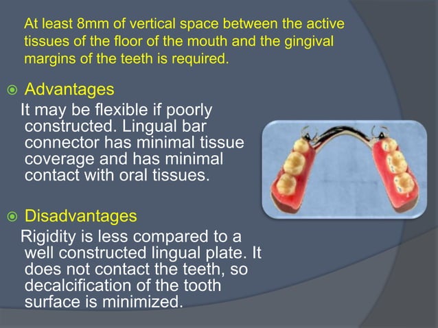 Mandibular Major Connectors | PPTX