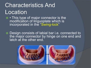 Mandibular Major Connectors | PPTX