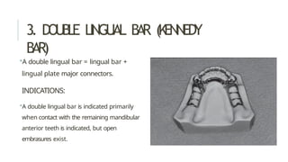 mandibularmajorconnectors-220110094500.pptx