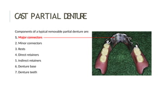 mandibularmajorconnectors-220110094500.pptx