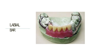 mandibularmajorconnectors-220110094500.pptx