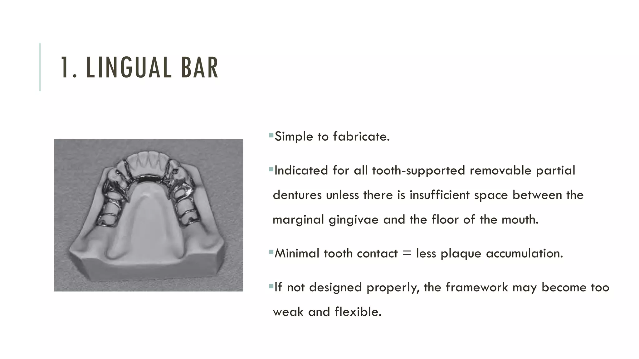 Mandibular Major Connectors | PDF
