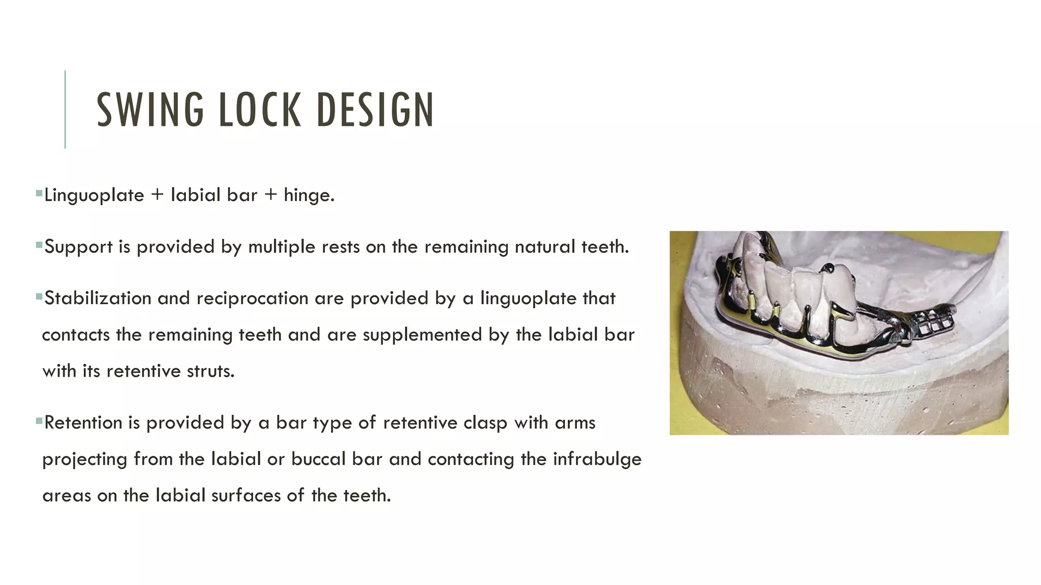 Mandibular Major Connectors | PDF